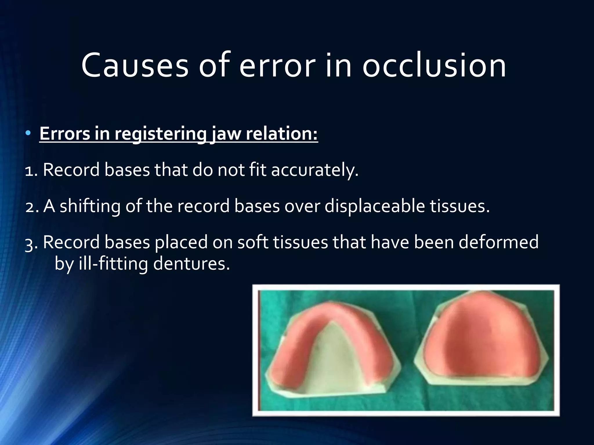 Remounting of complete dentures | PPTX