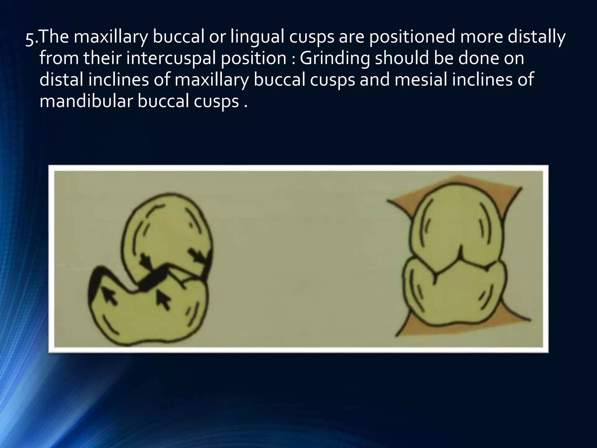 Remounting of complete dentures | PPTX