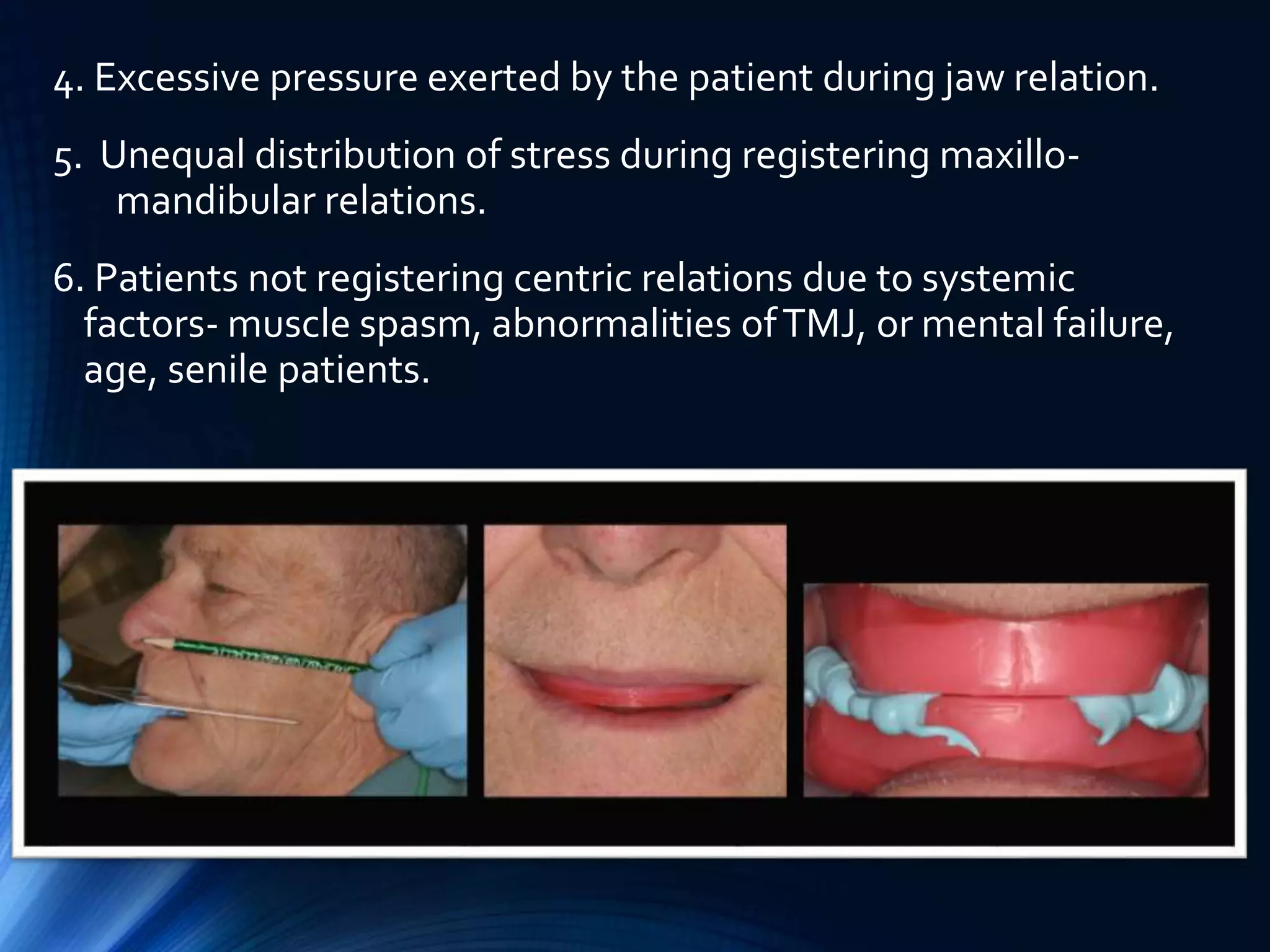 Remounting of complete dentures | PPTX