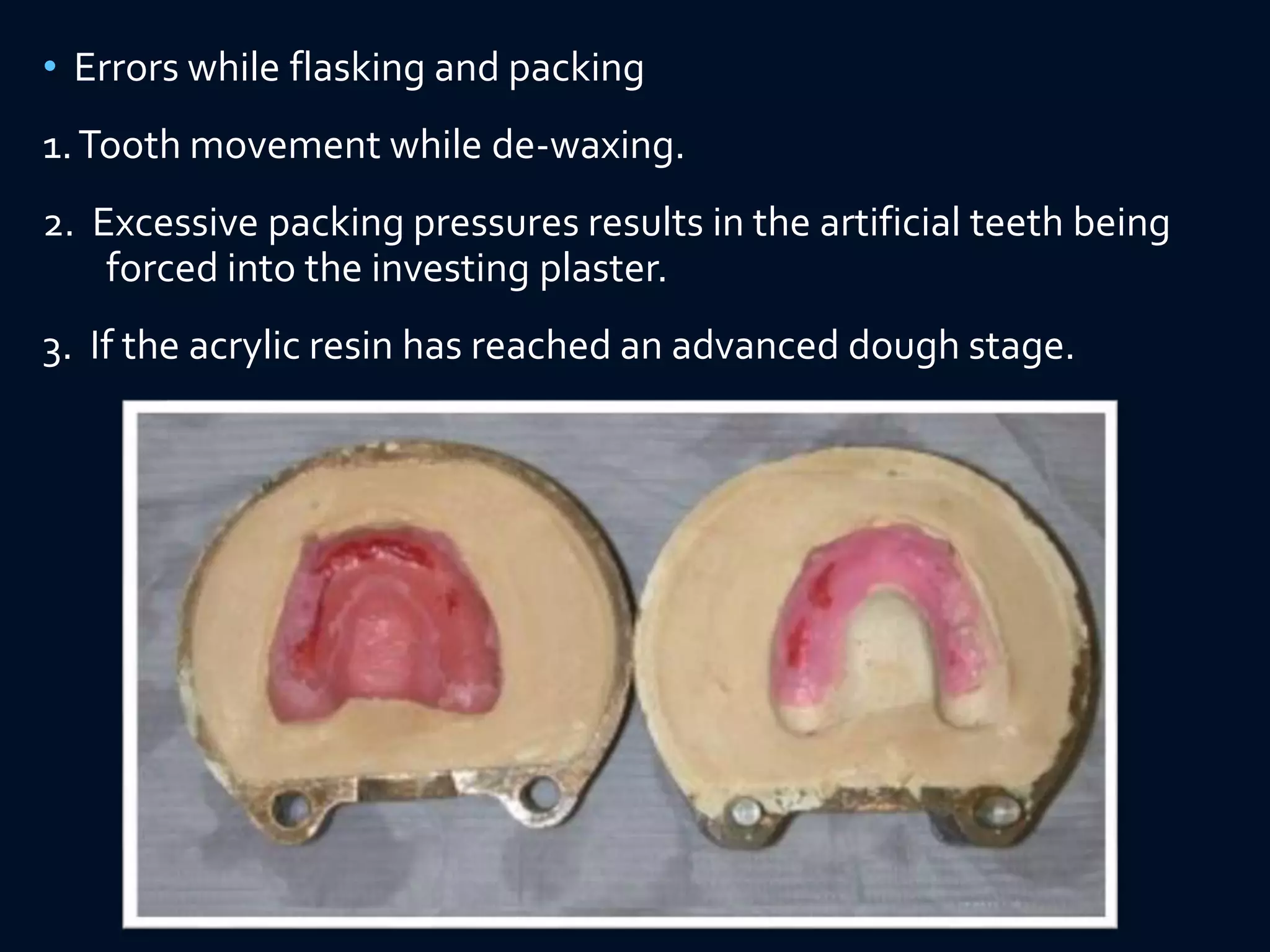 Remounting of complete dentures | PPTX