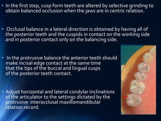 Remounting of complete dentures | PPTX