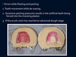 Remounting Of Complete Dentures Pptx