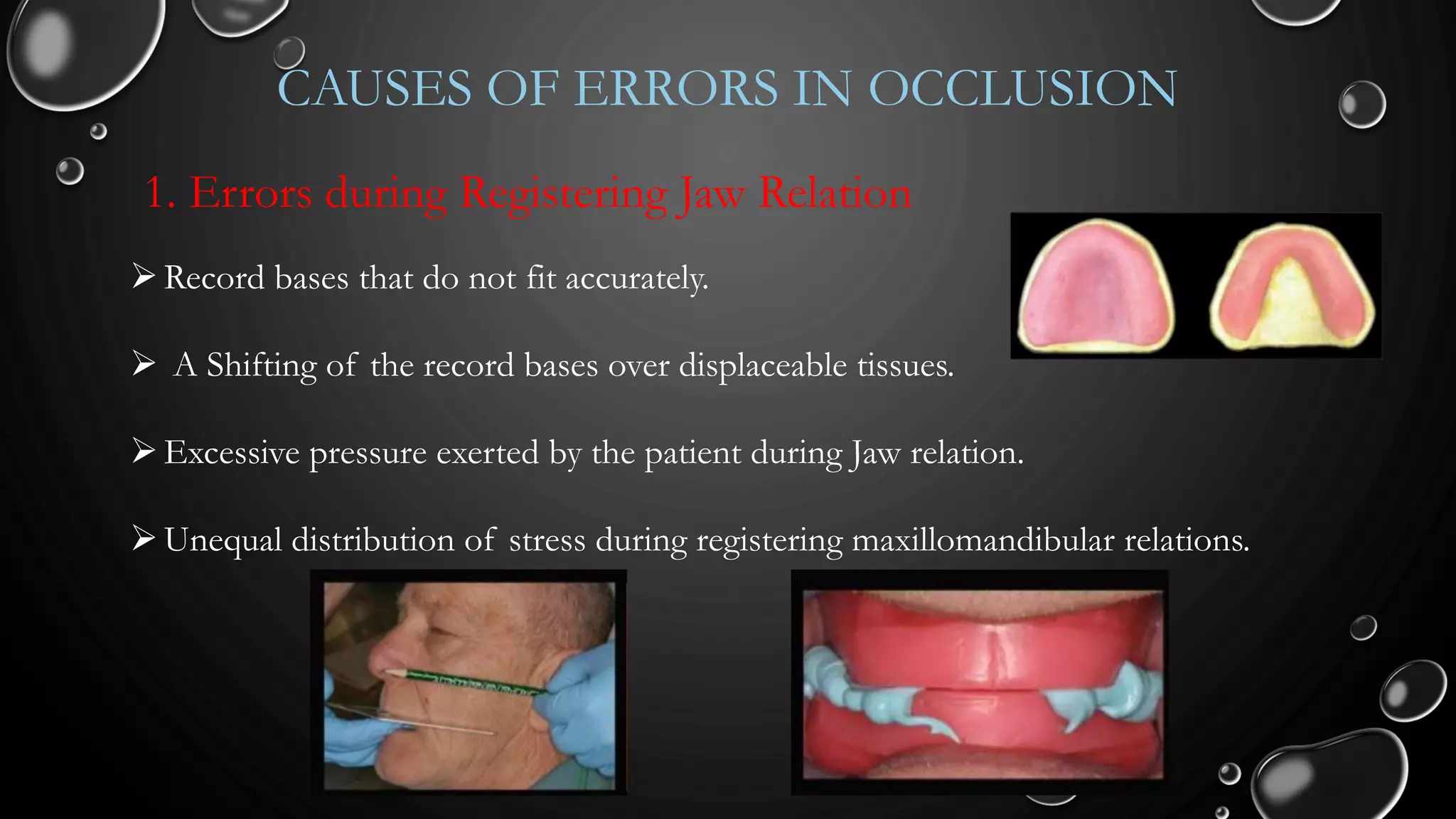 REMOUNTING PROCEDURES - ARUN.pdf