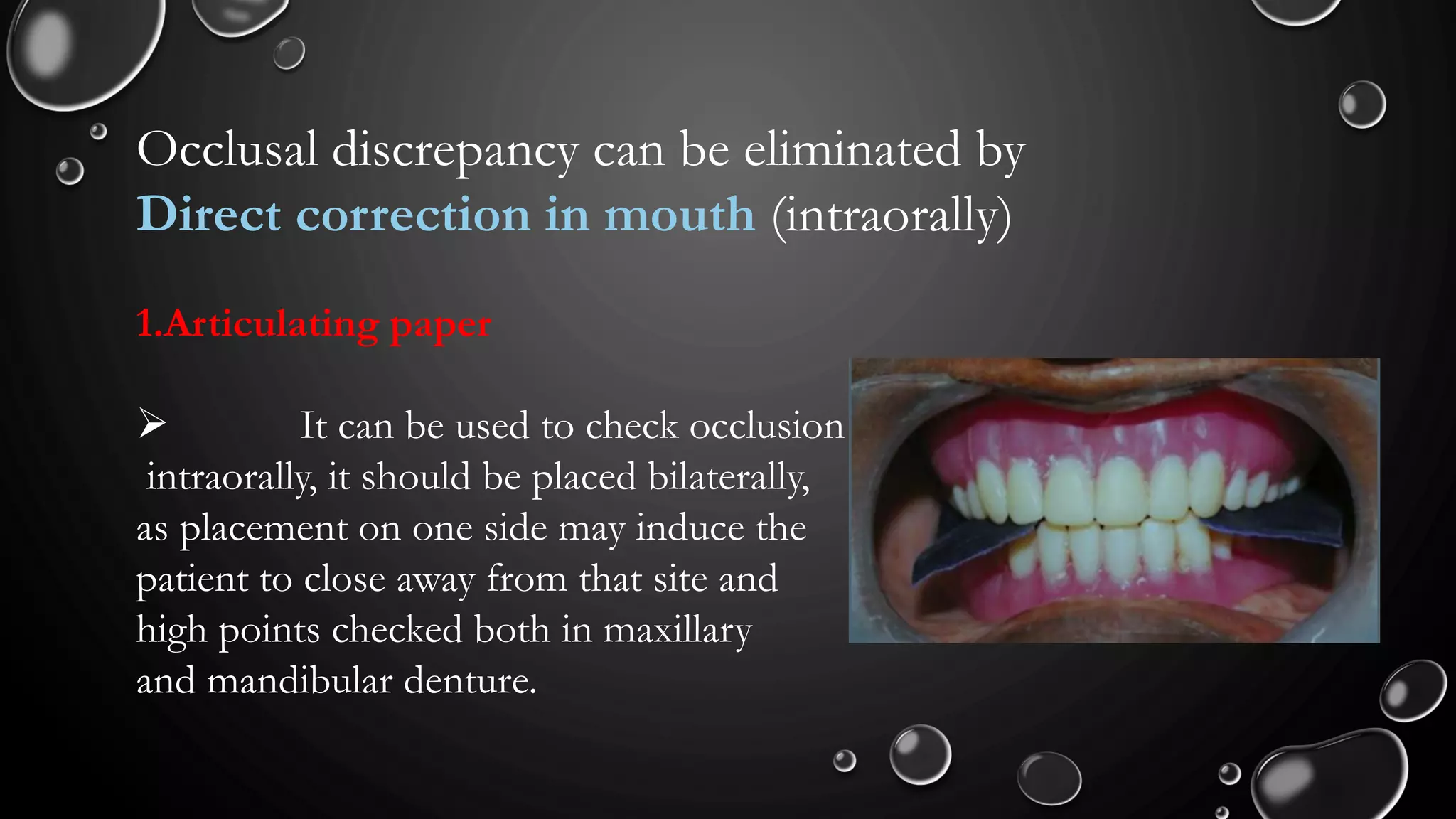 REMOUNTING PROCEDURES - ARUN.pdf