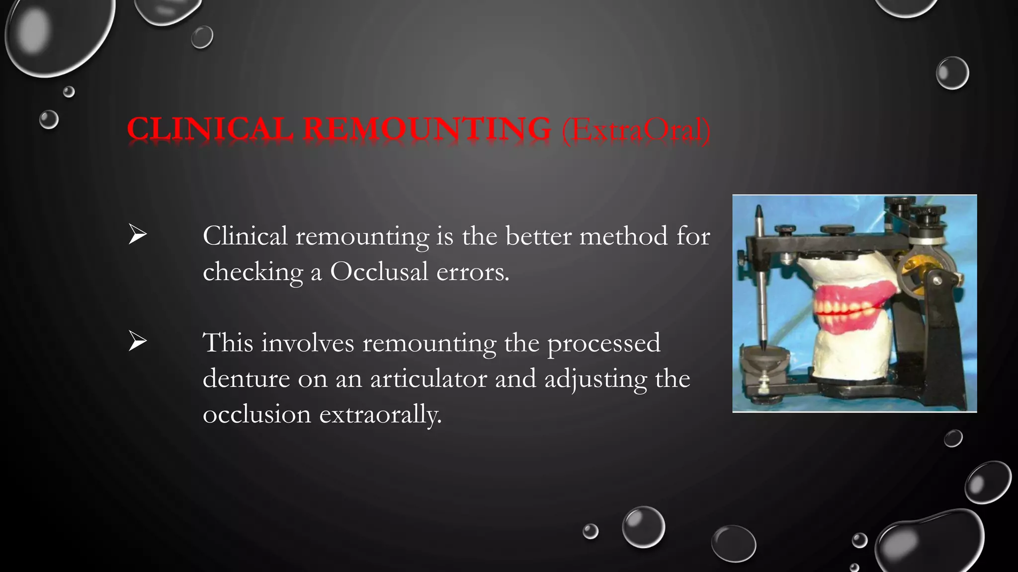 REMOUNTING PROCEDURES - ARUN.pdf