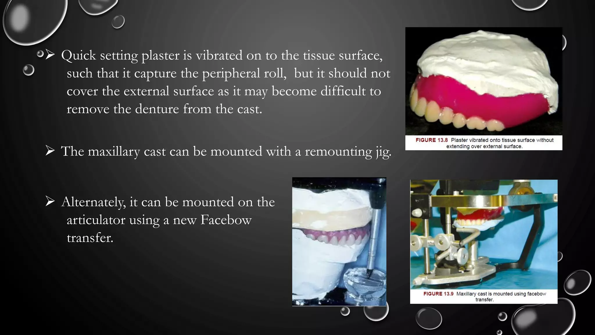REMOUNTING PROCEDURES - ARUN.pdf