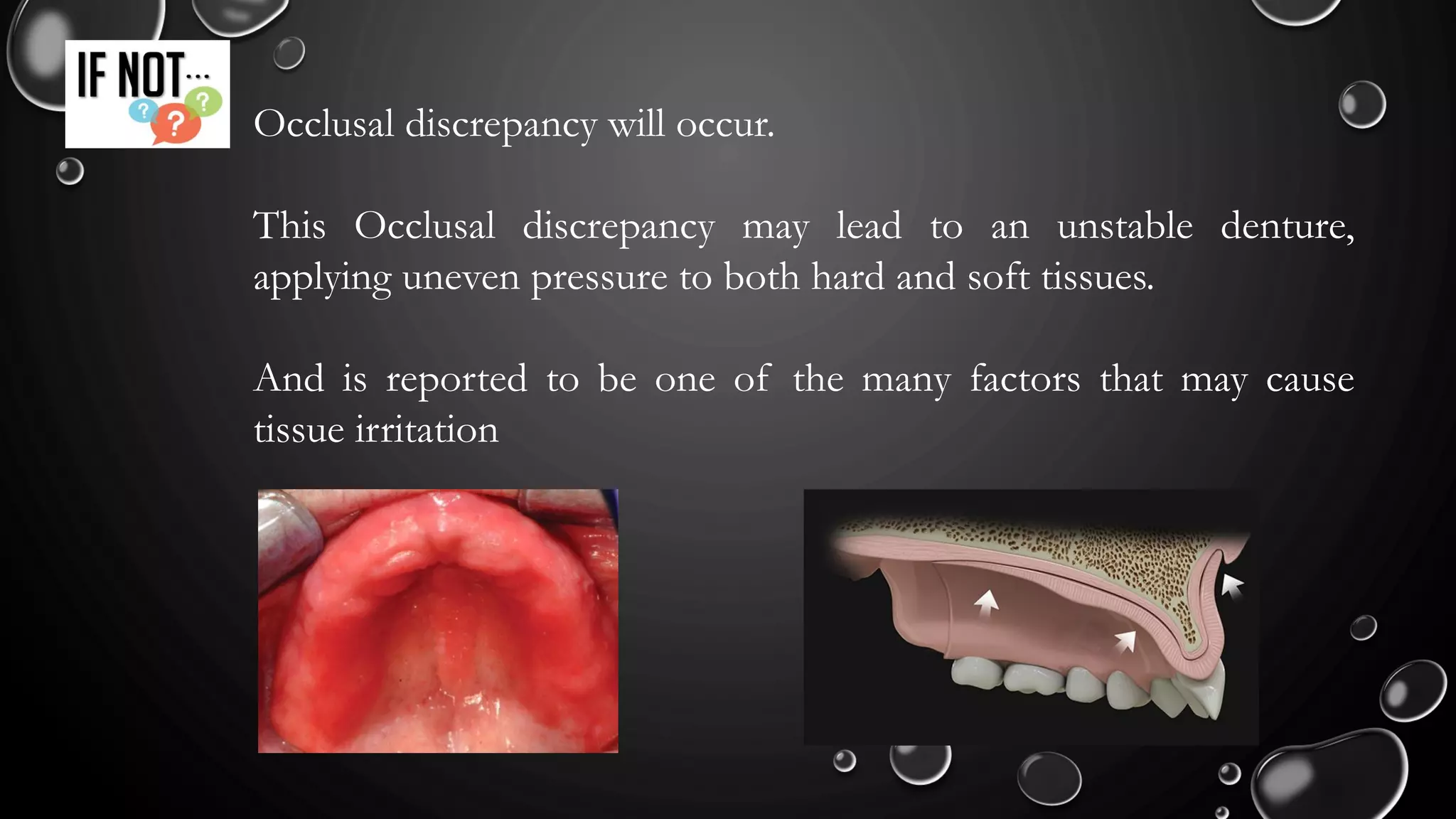 REMOUNTING PROCEDURES - ARUN.pdf