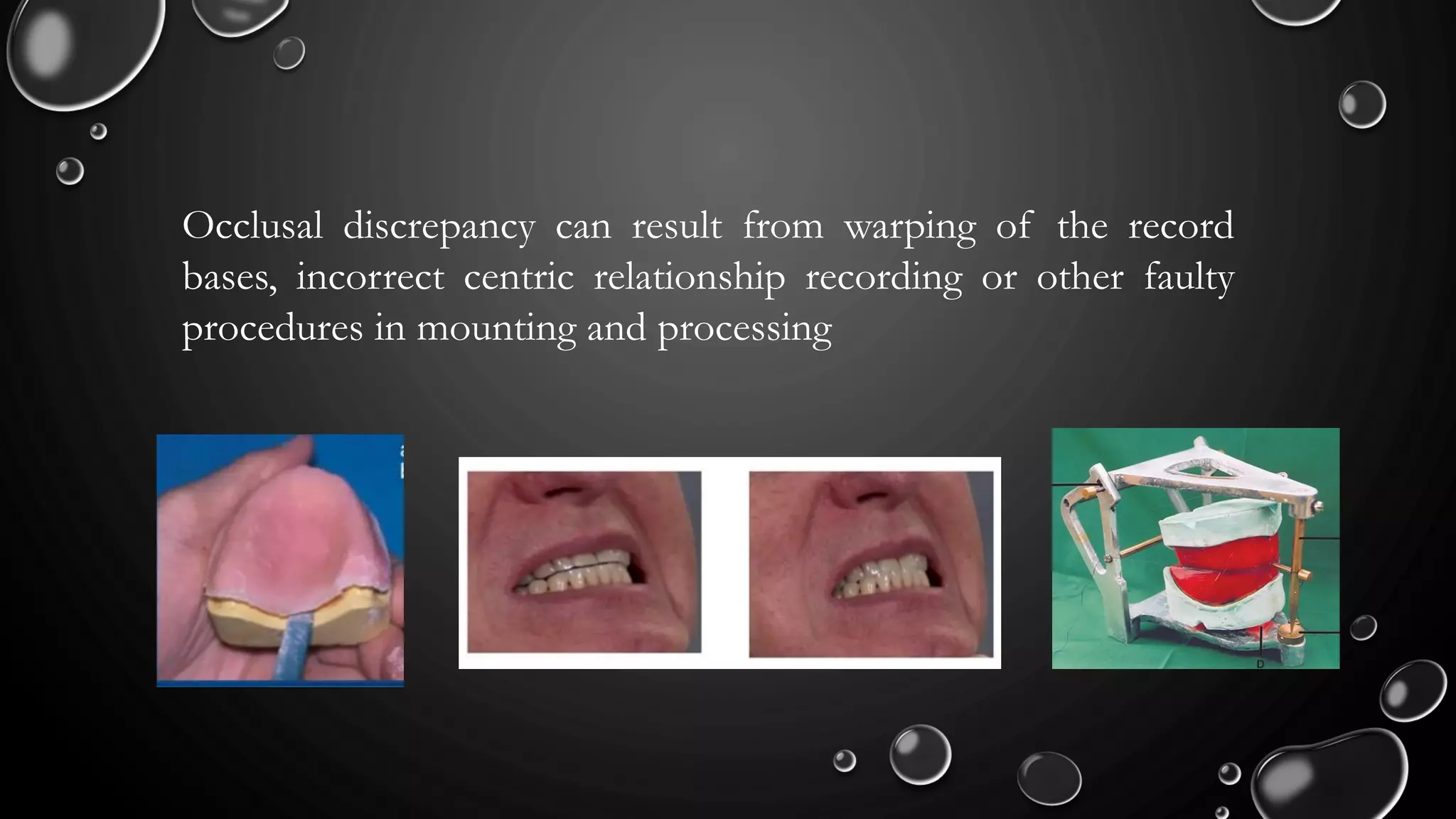 REMOUNTING PROCEDURES - ARUN.pdf