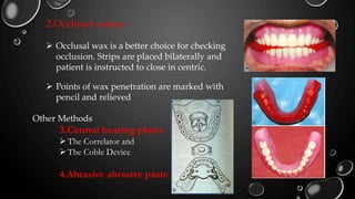 REMOUNTING PROCEDURES - ARUN.pdf