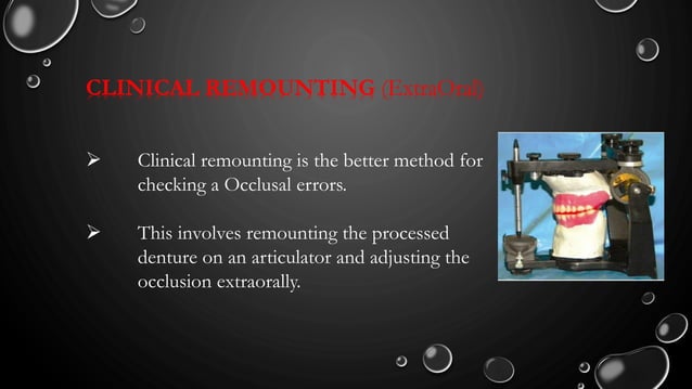 REMOUNTING PROCEDURES - ARUN.pdf