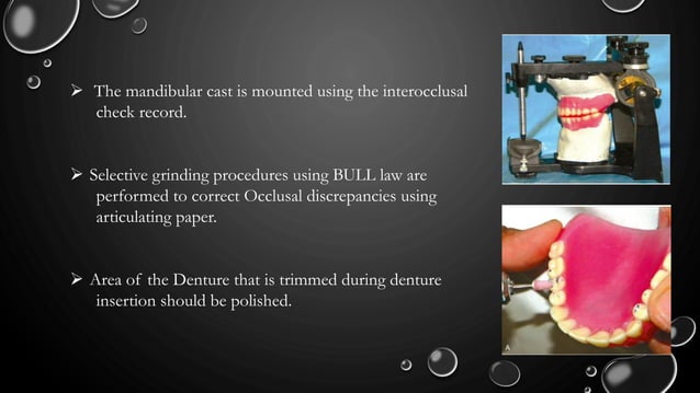 REMOUNTING PROCEDURES - ARUN.pdf