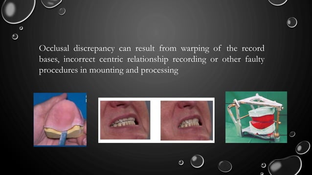 REMOUNTING PROCEDURES - ARUN.pdf