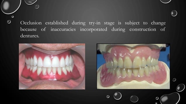 REMOUNTING PROCEDURES - ARUN.pdf