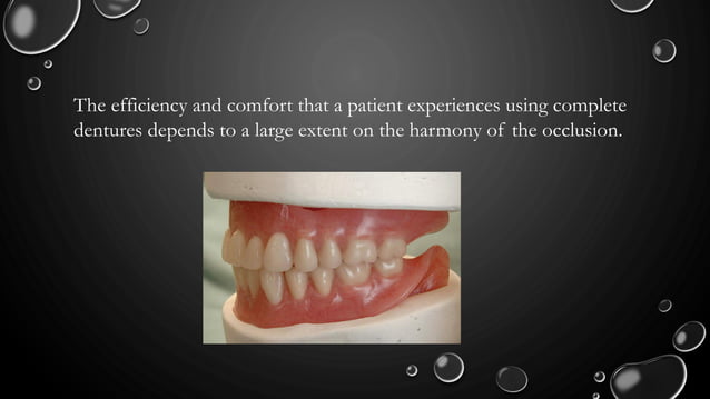 REMOUNTING PROCEDURES - ARUN.pdf