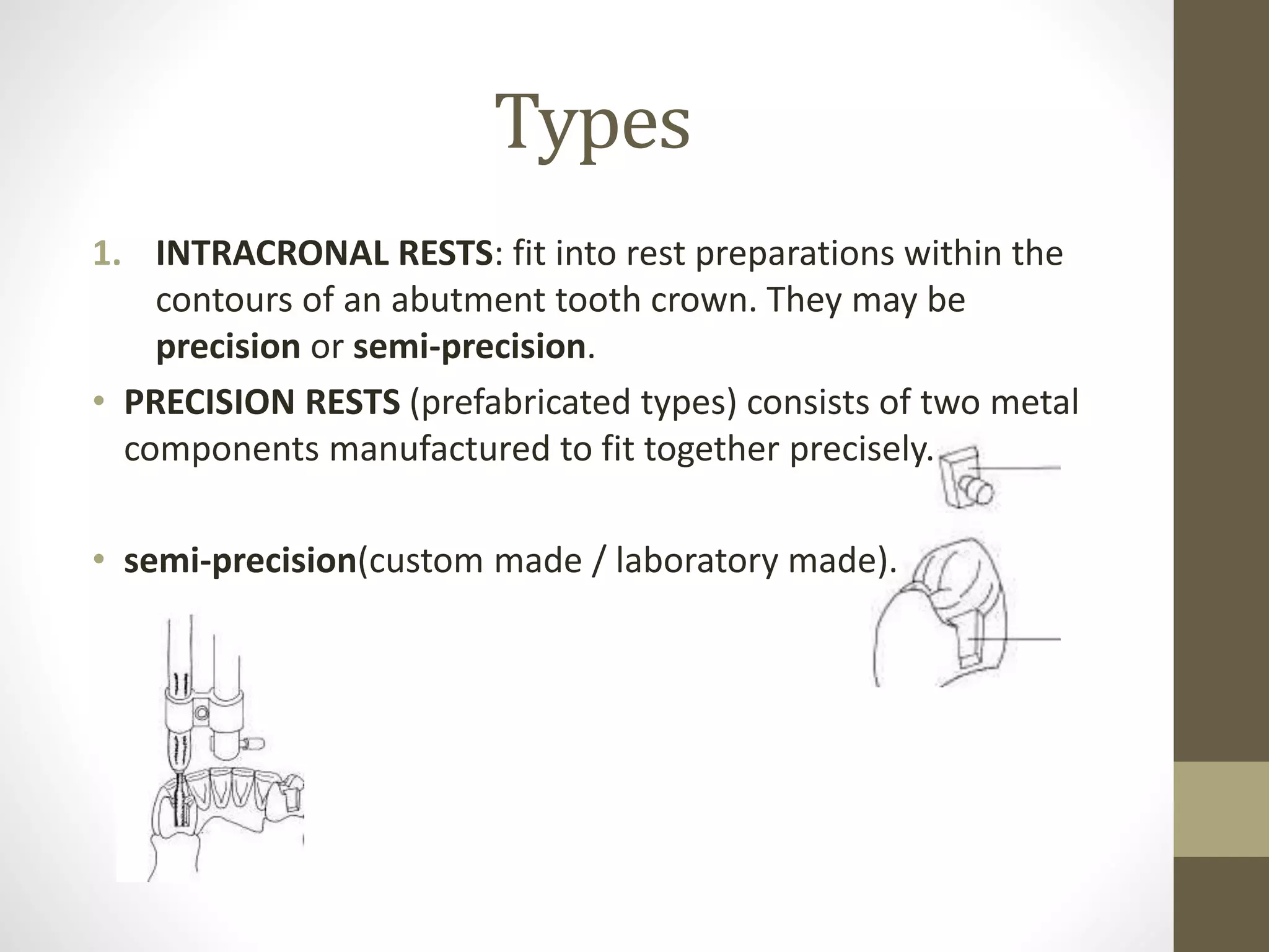 Preparation of the mouth for removable partial denture | PPTX