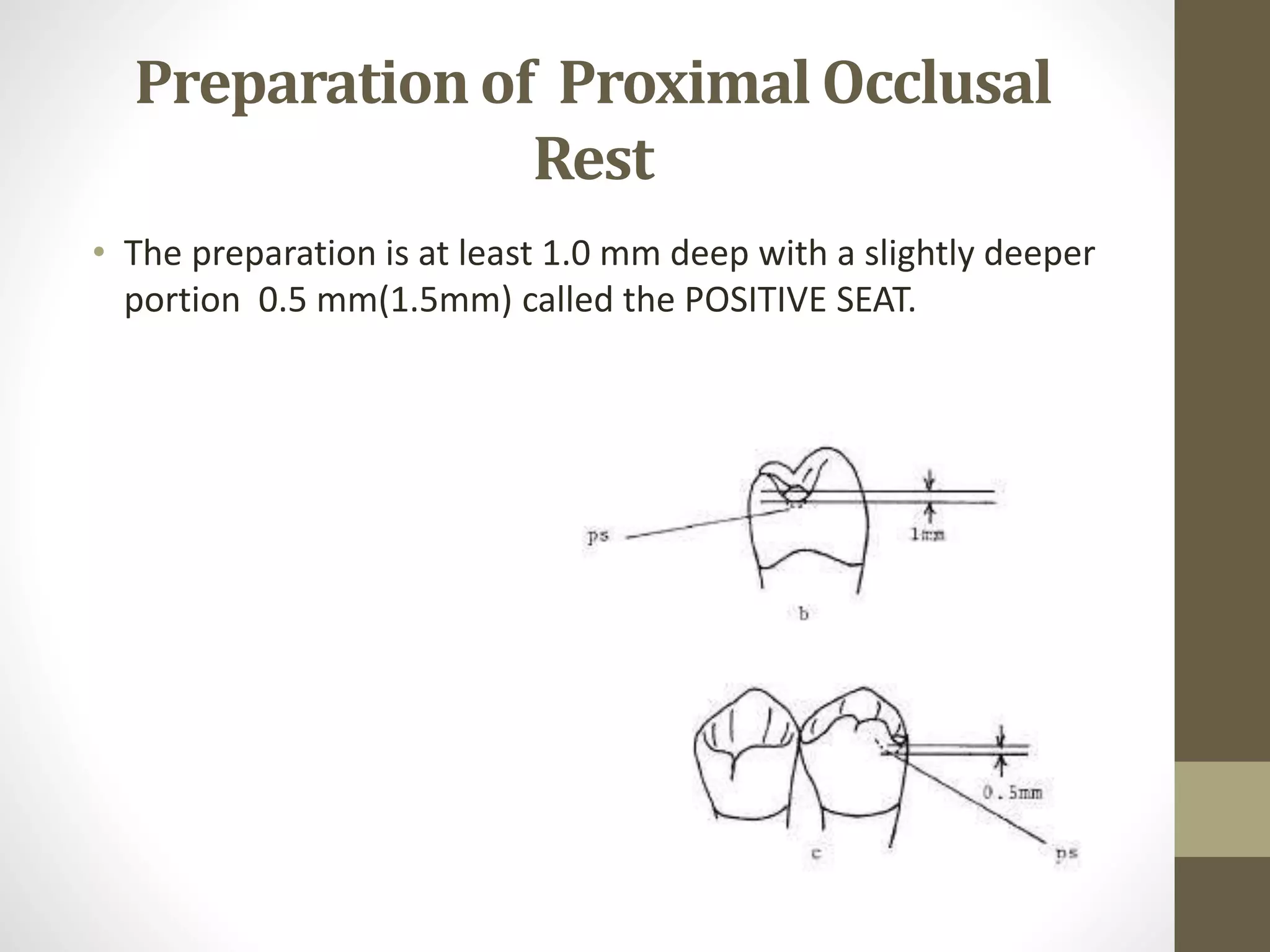 Preparation of the mouth for removable partial denture | PPTX