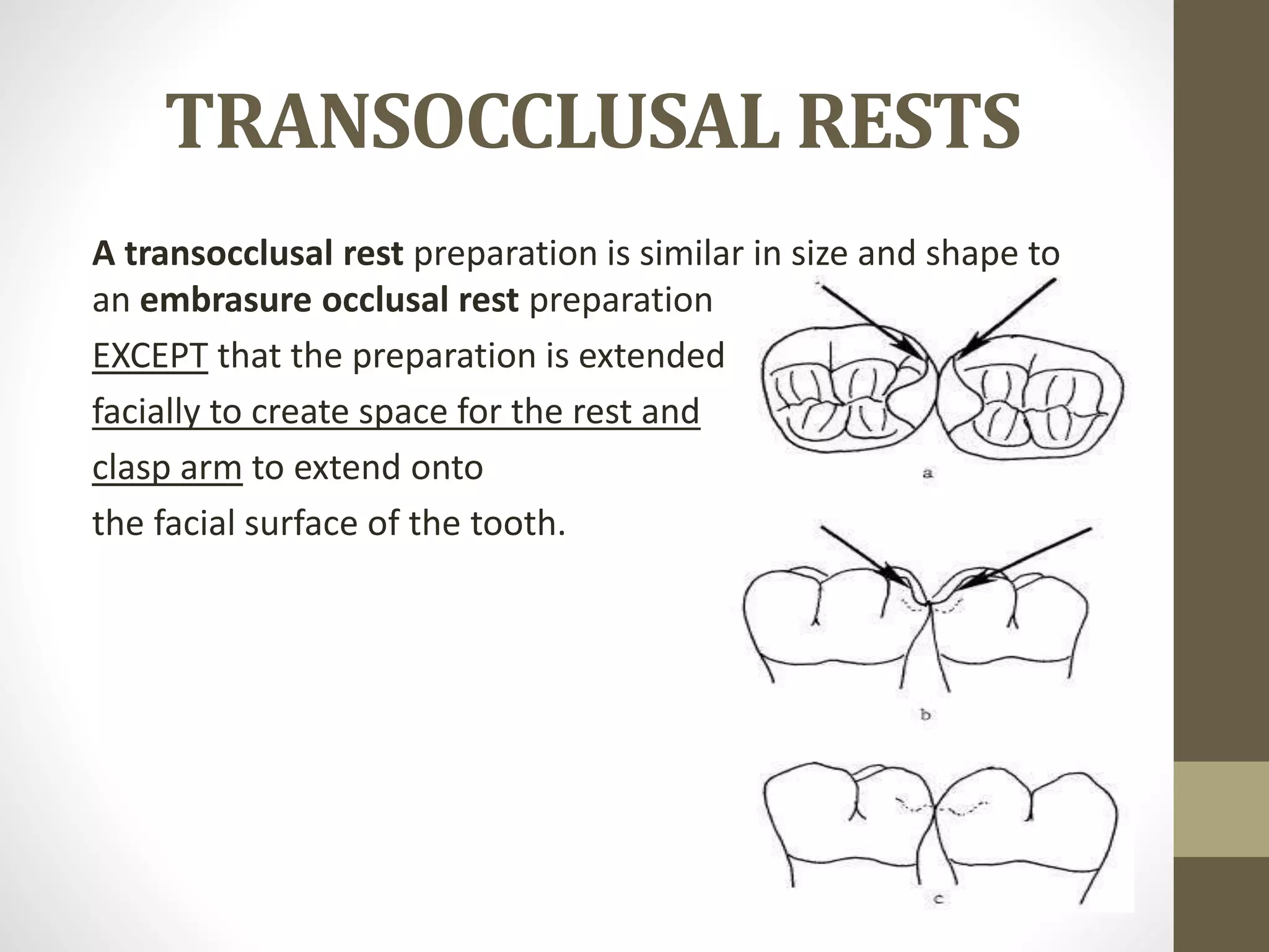 Preparation of the mouth for removable partial denture | PPTX
