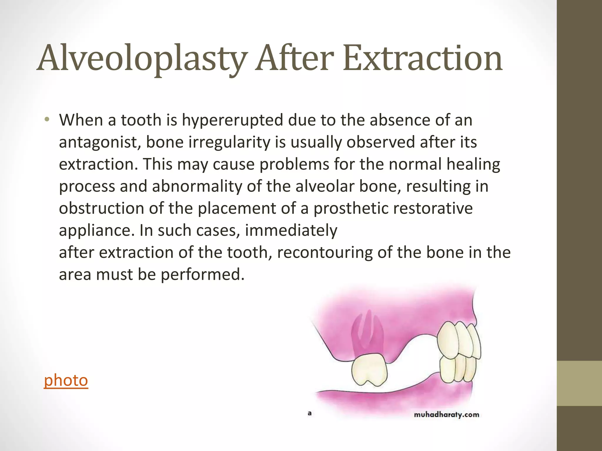 Preparation Of The Mouth For Removable Partial Denture Pptx