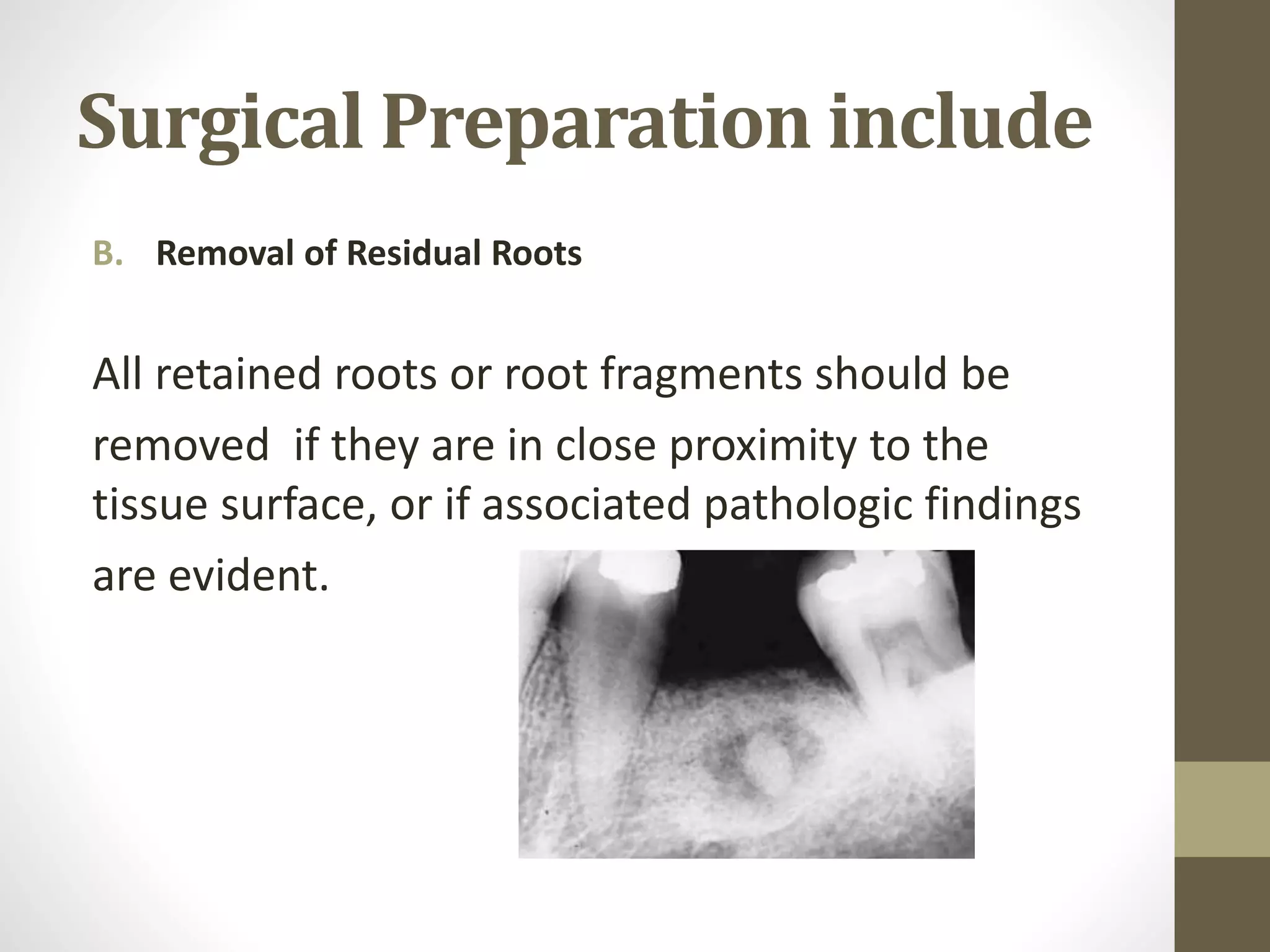 Preparation of the mouth for removable partial denture | PPTX