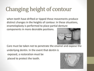 Preparation of the mouth for removable partial denture | PPTX