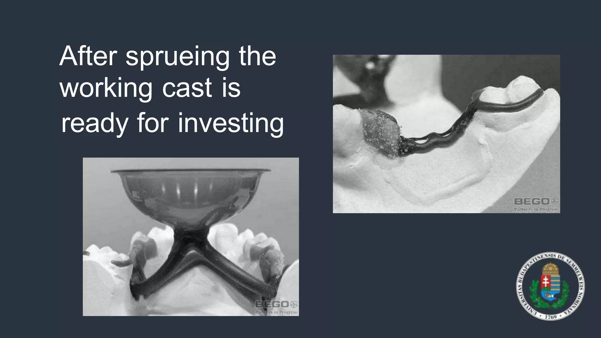 removable-partial-denture-f-f.pptx