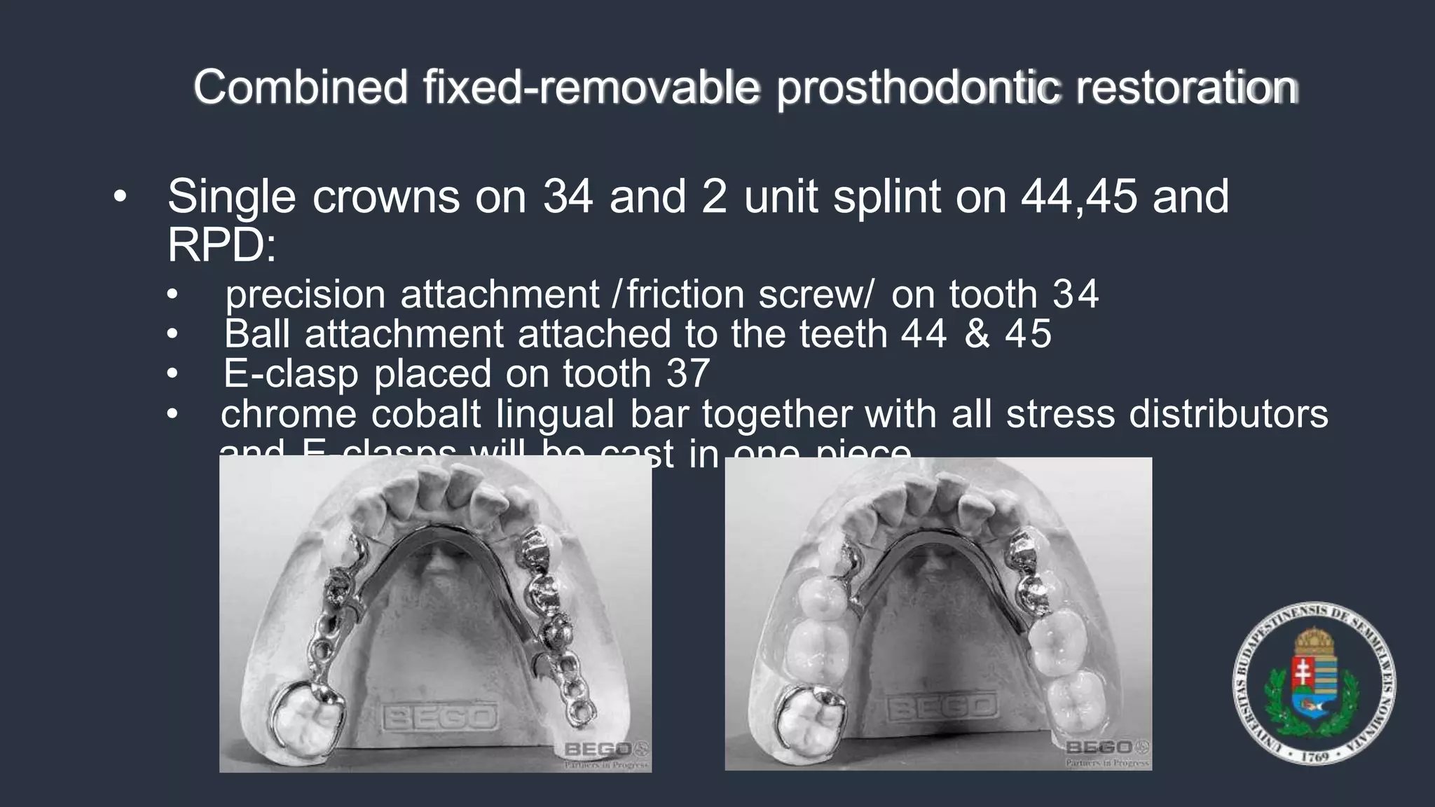 removable-partial-denture-f-f.pptx