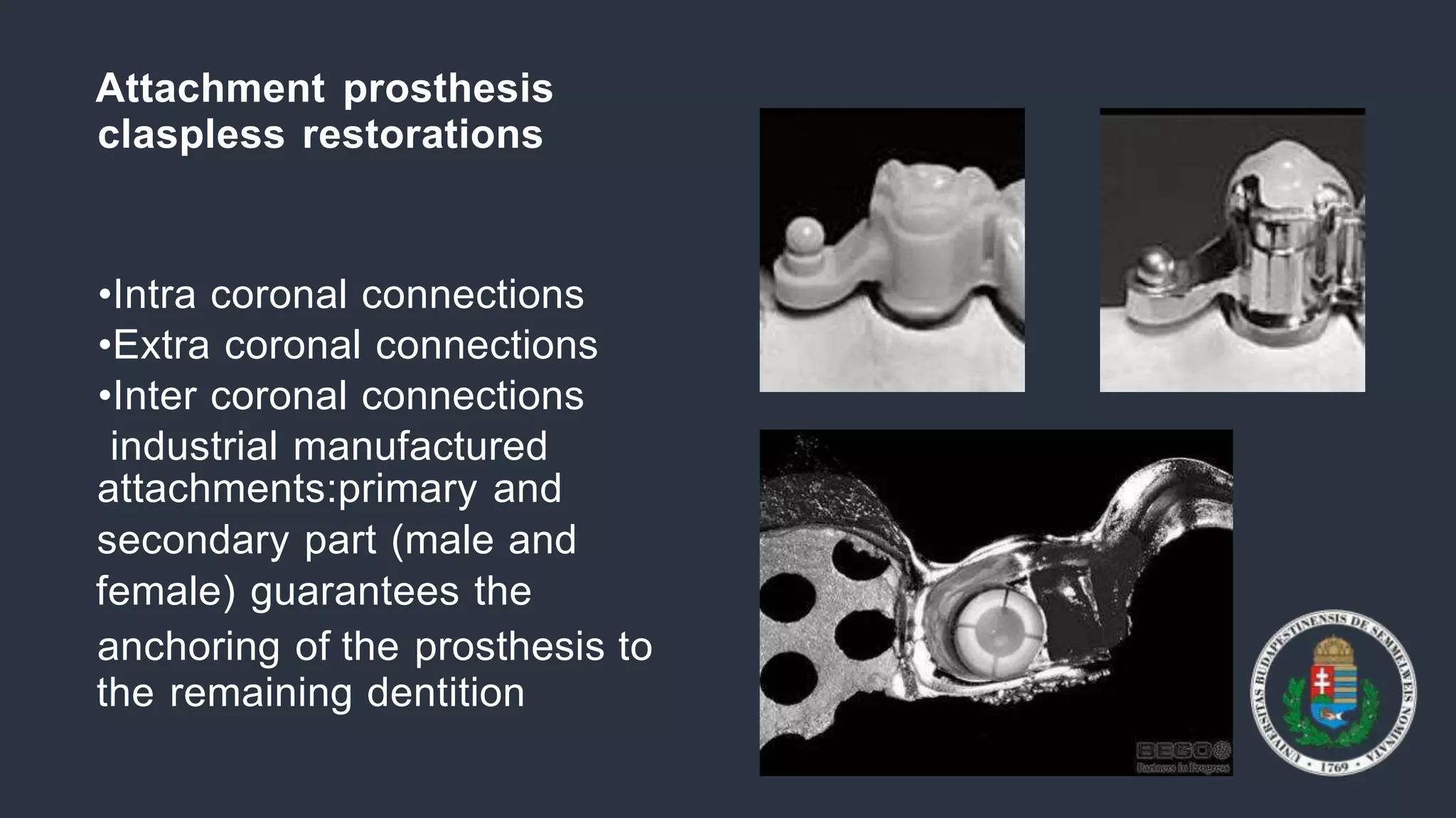 removable-partial-denture-f-f.pptx