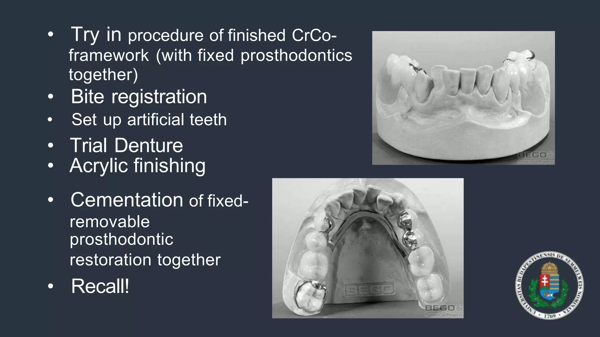 removable-partial-denture-f-f.pptx