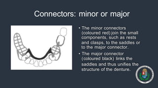 removable-partial-denture-f-f.pptx