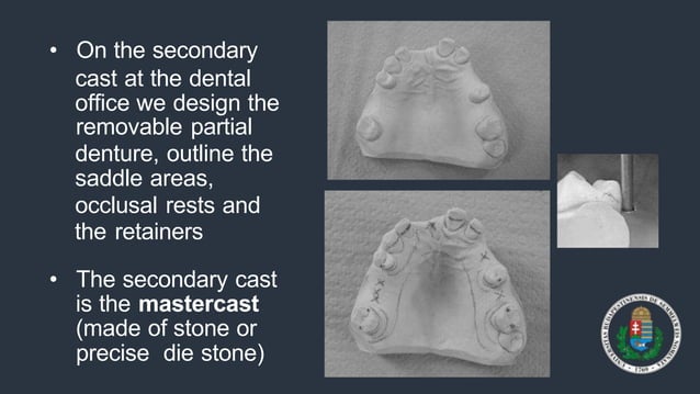 removable-partial-denture-f-f.pptx