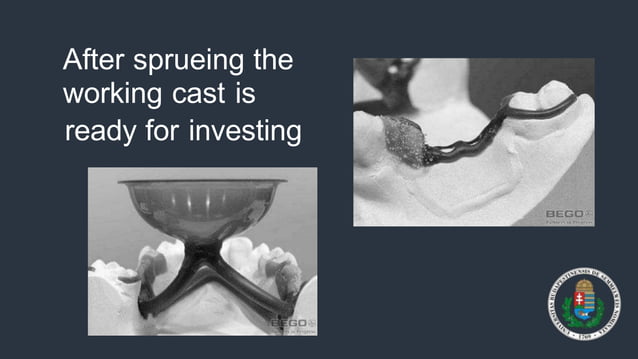 removable-partial-denture-f-f.pptx