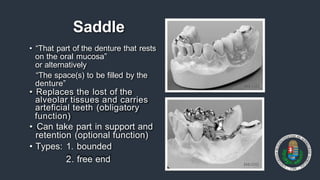 removable-partial-denture-f-f.pptx