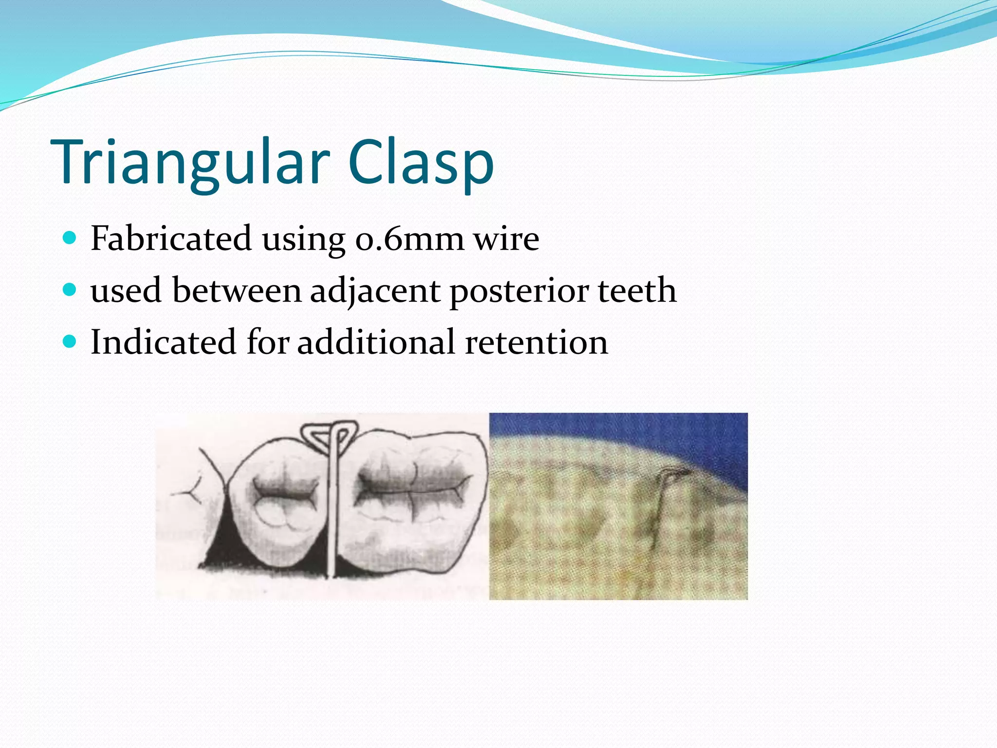 Removable appliances | PPTX