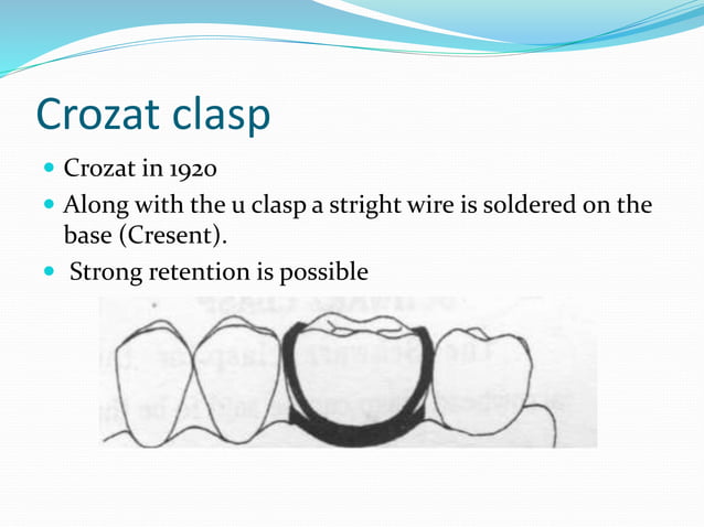 Removable appliances | PPTX