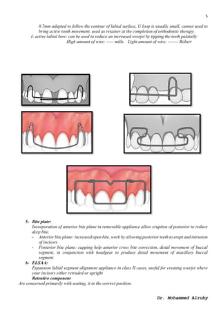Removable appliances.docx