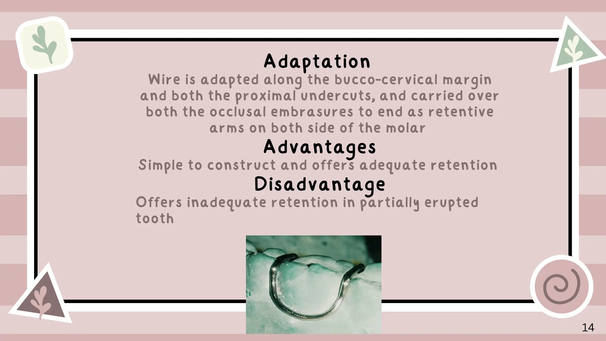 Removable Appliances in Orthodontics | PPT | PDF
