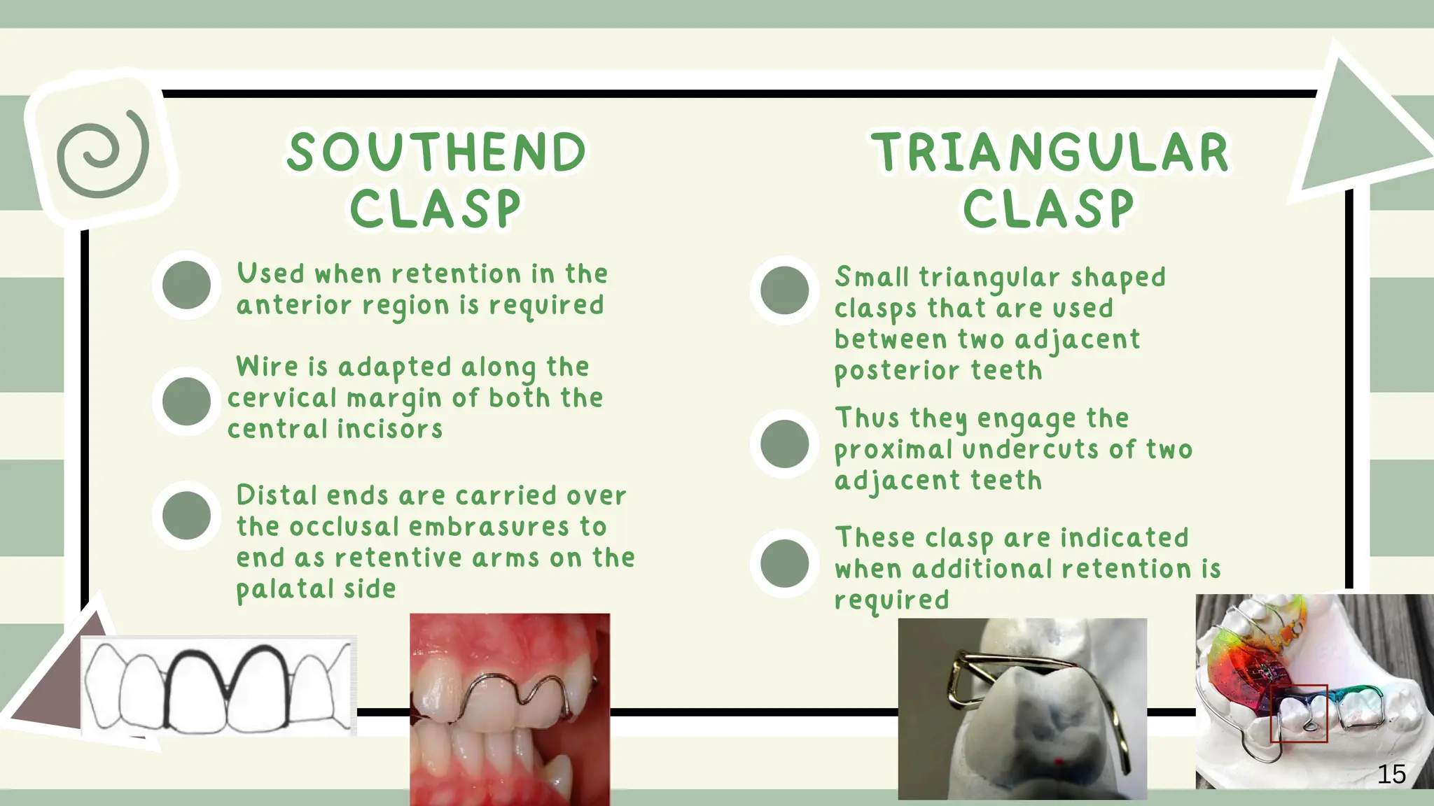 Removable Appliances in Orthodontics | PPT | PDF
