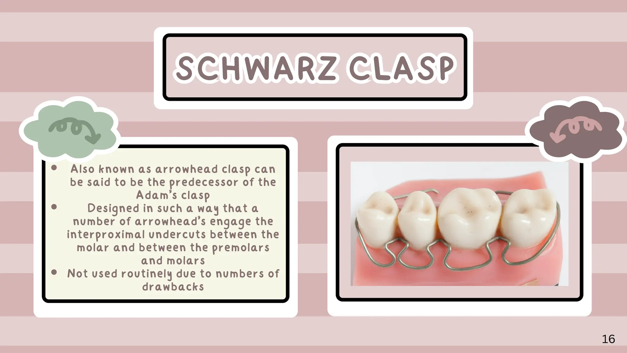 Removable Appliances in Orthodontics | PPT | PDF
