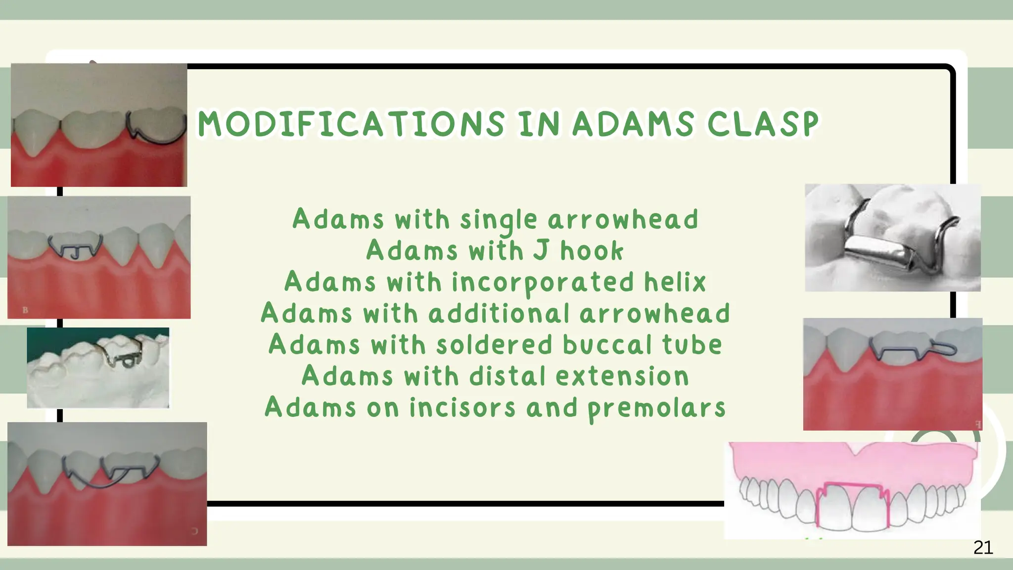 Removable Appliances in Orthodontics | PPT | PDF