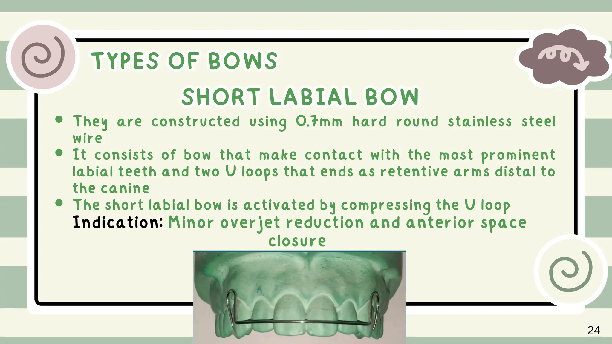 Removable Appliances in Orthodontics | PPT | PDF