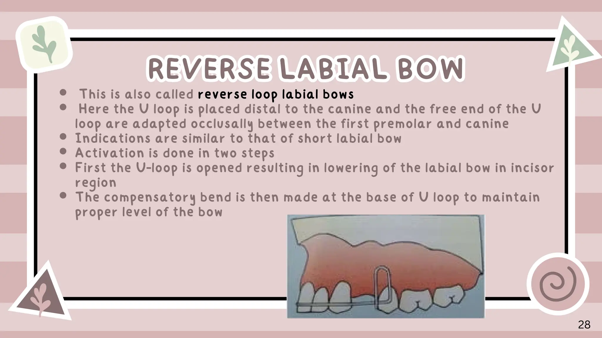 Removable Appliances in Orthodontics | PPT | PDF