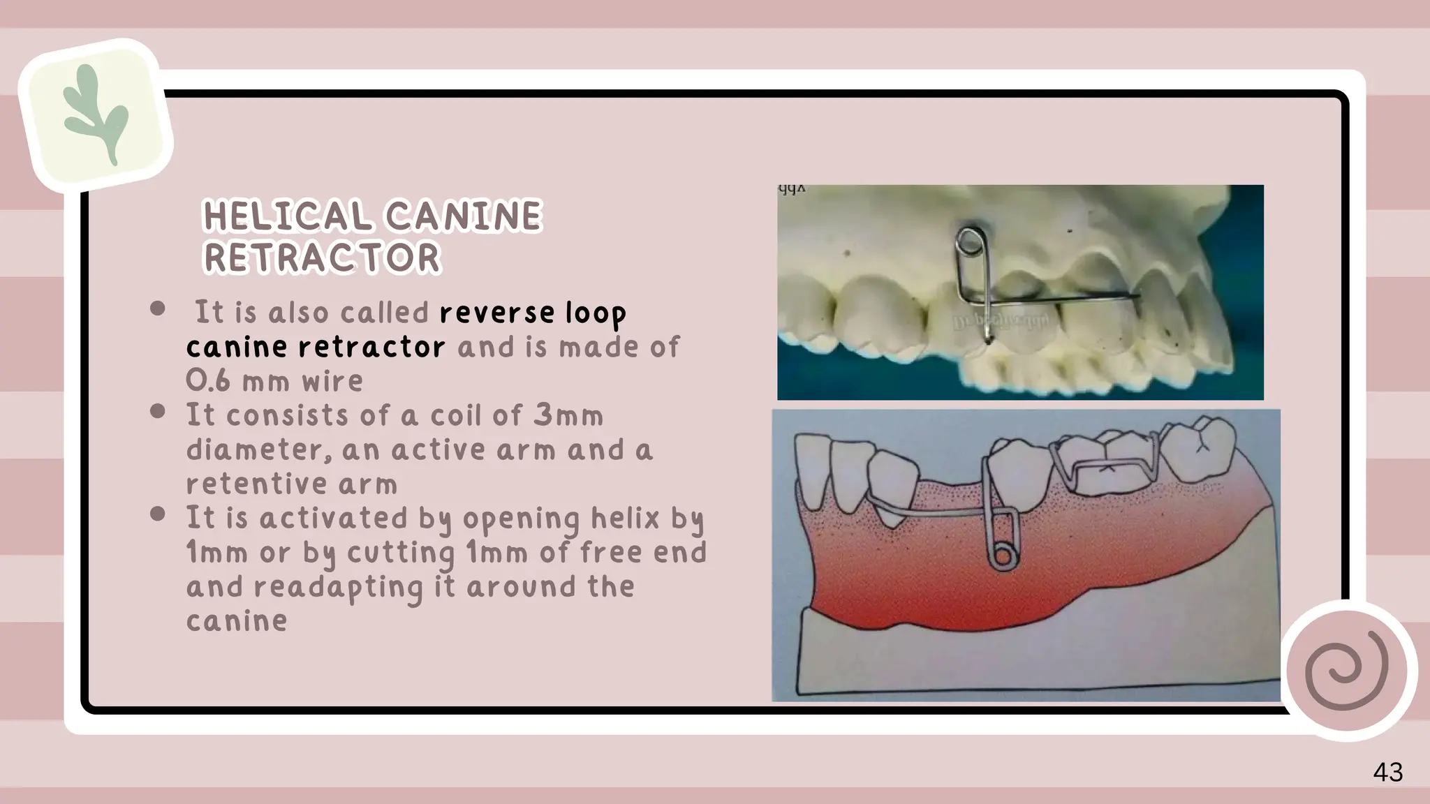 Removable Appliances in Orthodontics | PPT | PDF