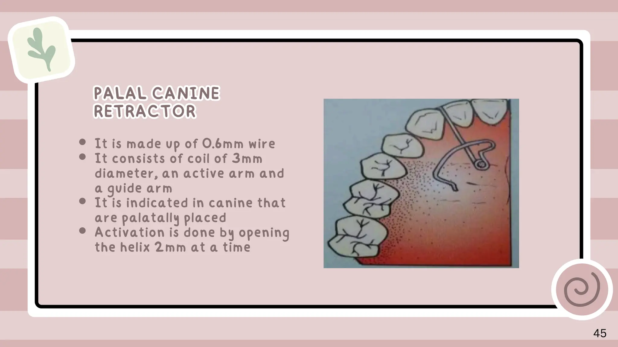 Removable Appliances in Orthodontics | PPT | PDF