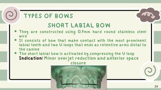 Removable Appliances in Orthodontics | PPT | PDF