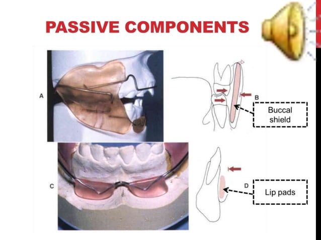 Removable appliances iii functional appliances | PPT