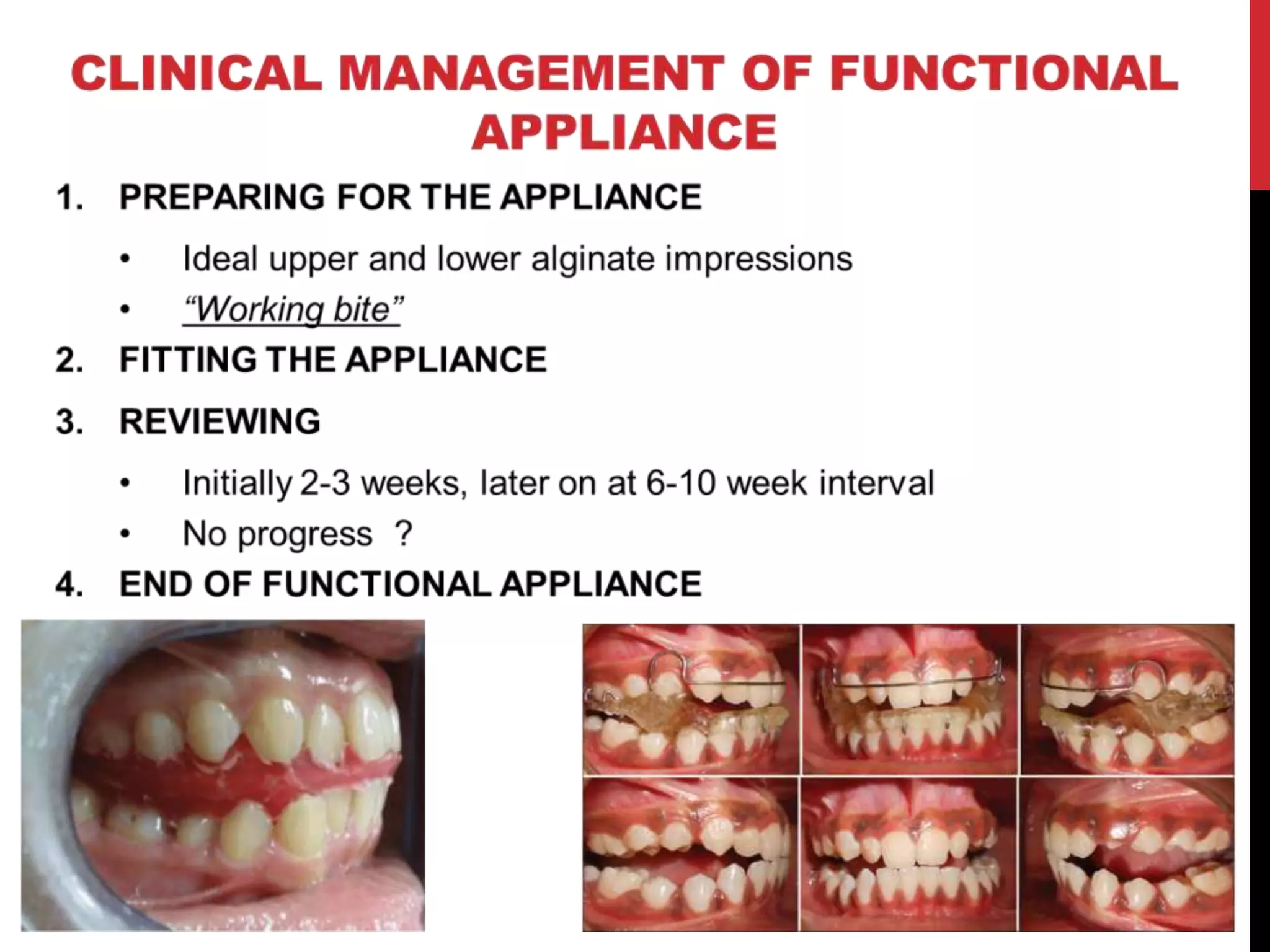 Removable appliances iii functional appliances ii | PPT
