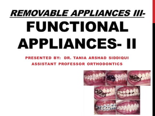 Removable appliances iii functional appliances ii | PPT