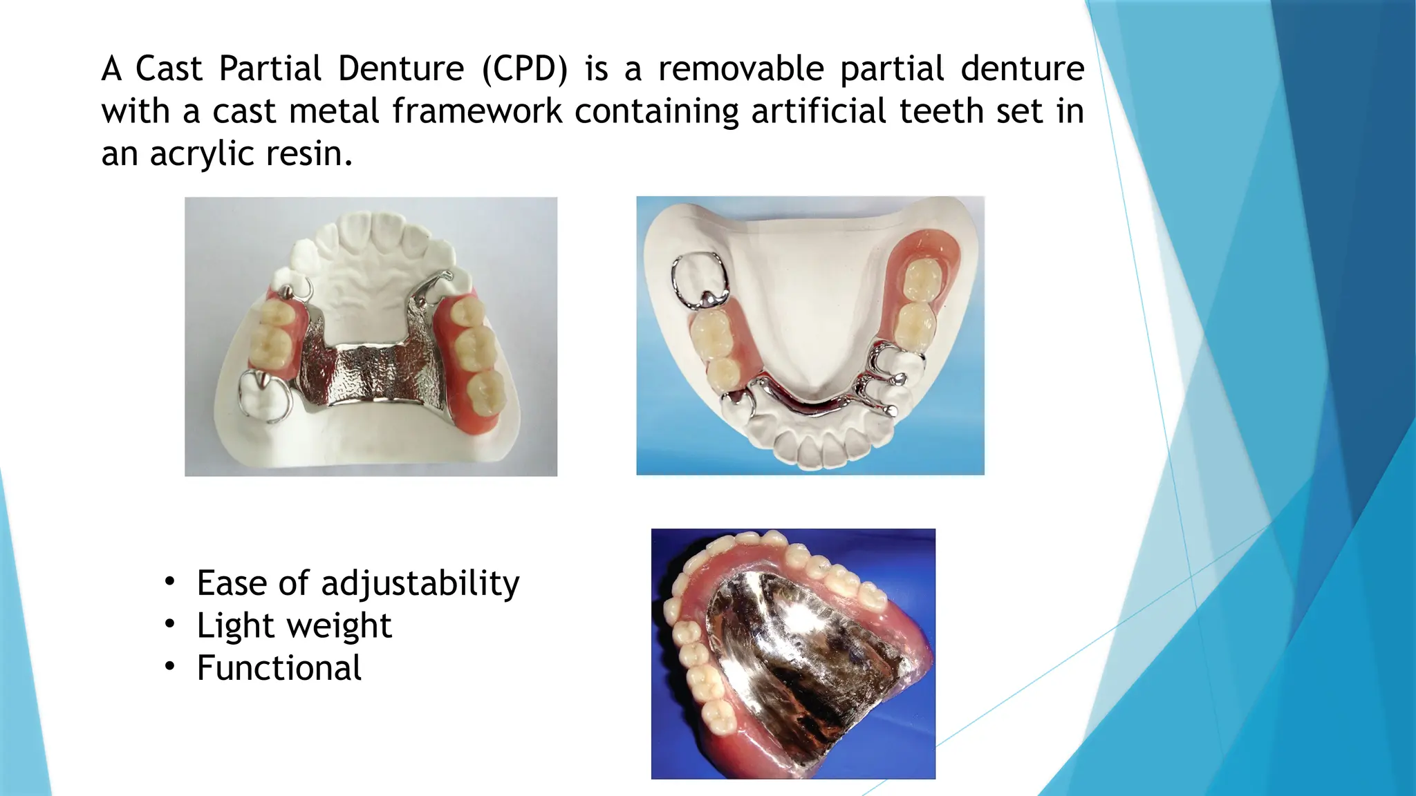 REMOVABLE Denture .pptx | Free Download