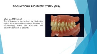 REMOVABLE Denture .pptx
