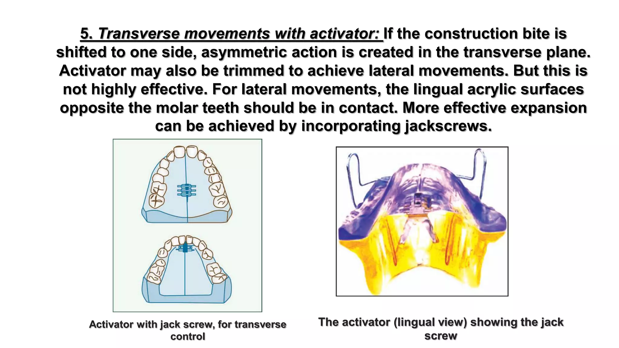 Removable functional appliance 2 | PPTX | Oral care | Personal Care